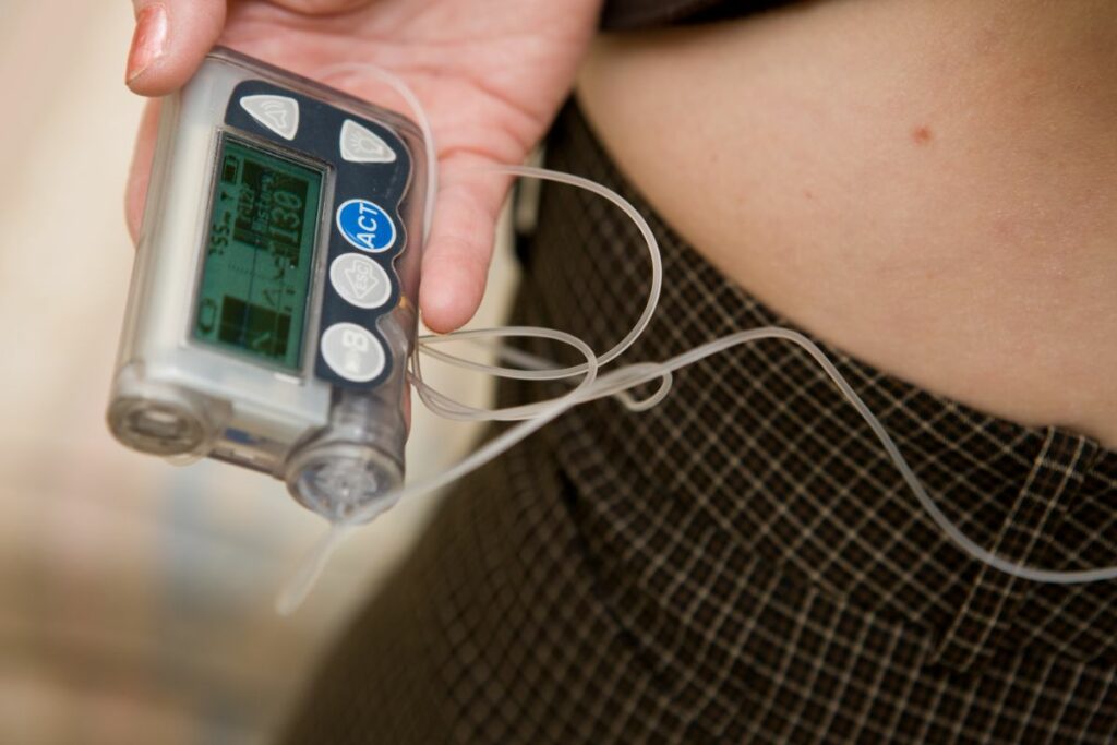 Insulin Pumps: Pros, Cons And Effectivness In Treating Diabetes - Alpha ...