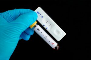 Unlock the key to health: when is an HIV test conclusive? Explore ...